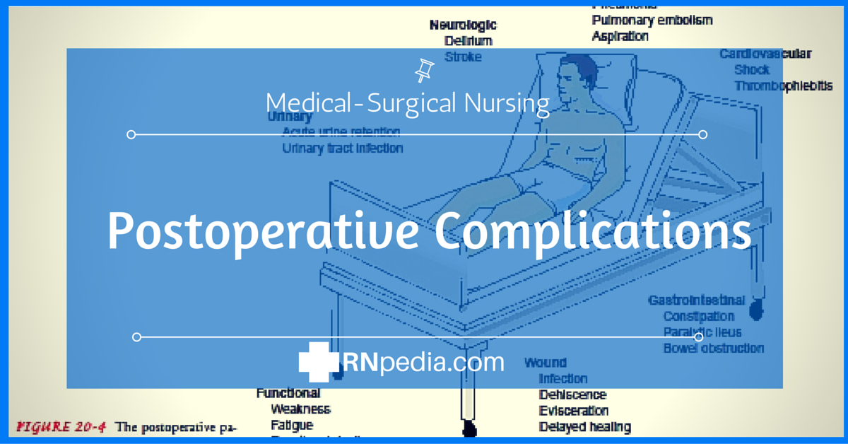 Postoperative Complications Rnpedia