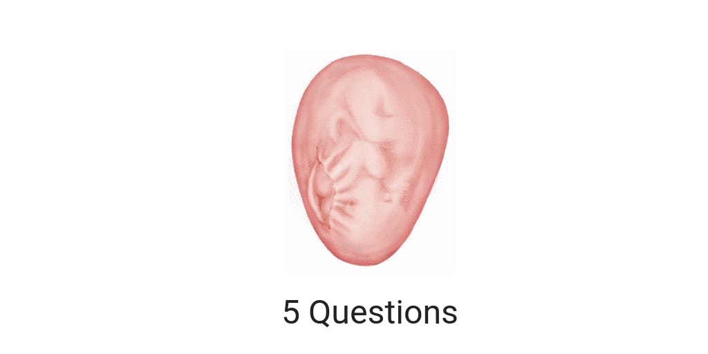 Uterine Rupture Practice Exam - RNpedia